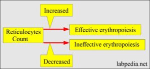 Reticulocyte count (retic count) and interpretations