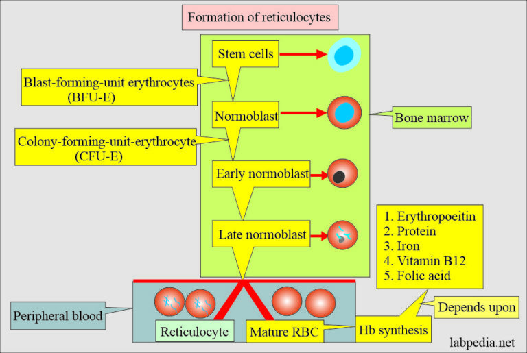 Reticulocyte count (retic count) and interpretations Reticulocyte count (retic count) and interpretations
