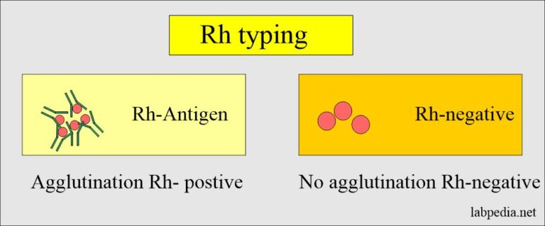 Blood banking:- part 1- Blood Groups ABO and Rh System, Blood Grouping ...