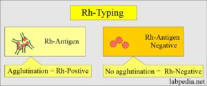 Blood banking:- part 1- Blood Groups ABO and Rh System, Blood Grouping ...