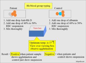 Blood banking:- part 1- Blood Groups ABO and Rh System, Blood Grouping ...