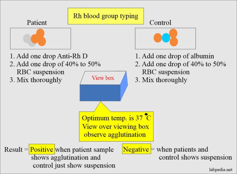 Blood banking:- part 1- Blood Groups ABO and Rh System, Blood Grouping ...