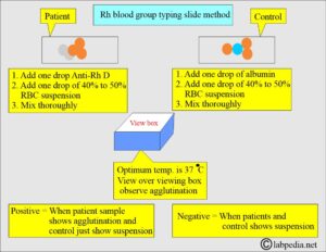 Blood banking:- part 1- Blood Groups ABO and Rh System, Blood Grouping ...