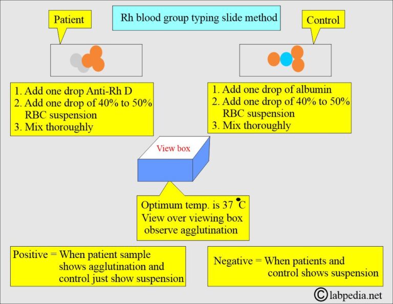 Blood banking:- part 1- Blood Groups ABO and Rh System, Blood Grouping ...