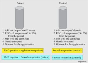Blood banking:- part 1- Blood Groups ABO and Rh System, Blood Grouping ...