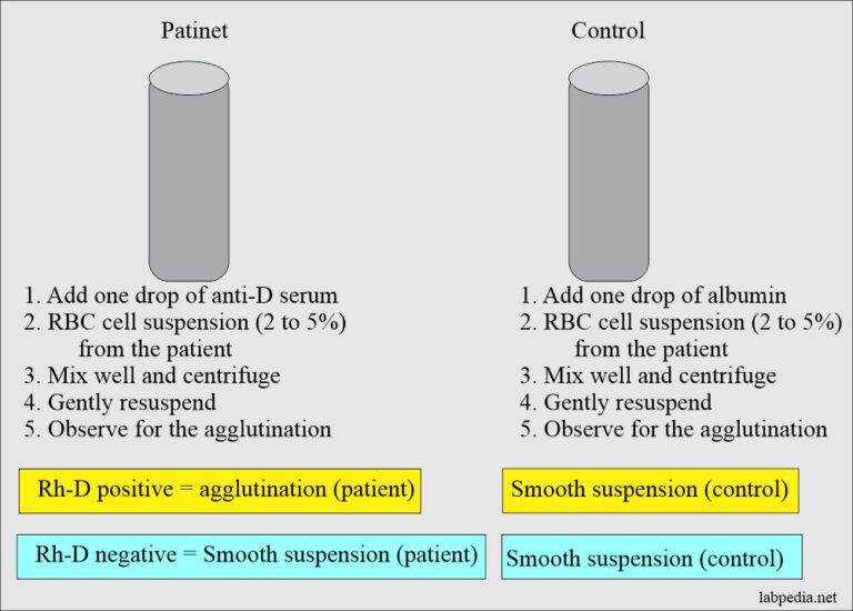 Blood banking:- part 1- Blood Groups ABO and Rh System, Blood Grouping ...