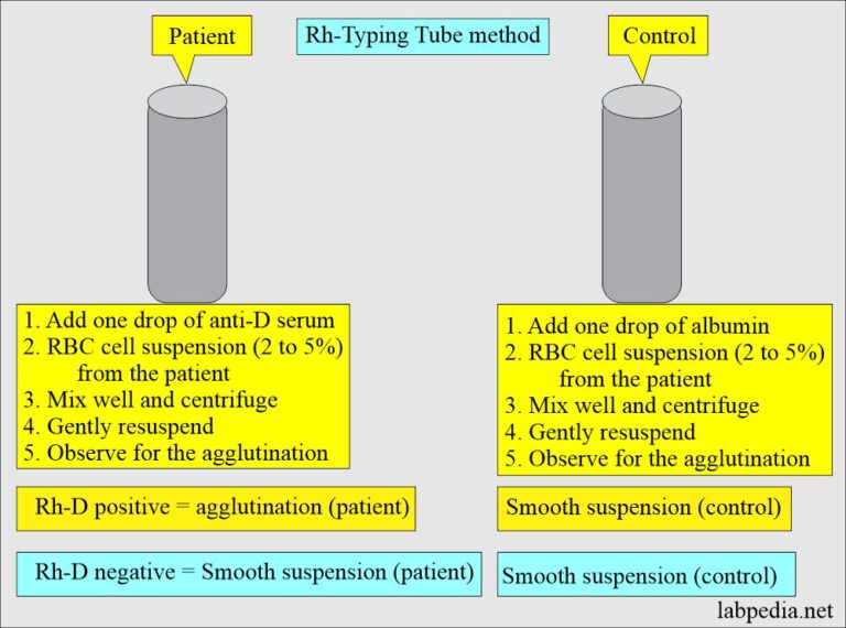Blood banking:- part 1- Blood Groups ABO and Rh System, Blood Grouping ...