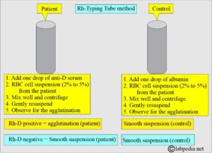 Blood banking:- part 1- Blood Groups ABO and Rh System, Blood Grouping ...