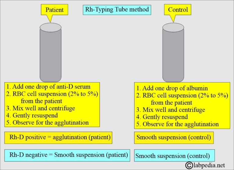 Blood banking:- part 1- Blood Groups ABO and Rh System, Blood Grouping ...