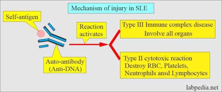 Anti-DNA, (anti-double-stranded DNA antibodies, Anti-ds-DNA Ab) and ...