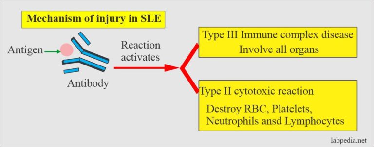 Anti-DNA, (anti-double-stranded DNA antibodies, Anti-ds-DNA Ab) and ...