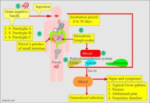 Salmonella Paratyphi, Paratyphoid Fever, Diagnosis and Treatment