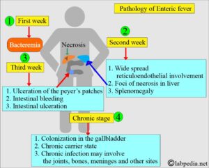 Typhoid Fever, Enteric Fever (Salmonella typhi)