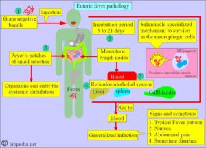 Typhoid Fever, Enteric Fever (Salmonella typhi)