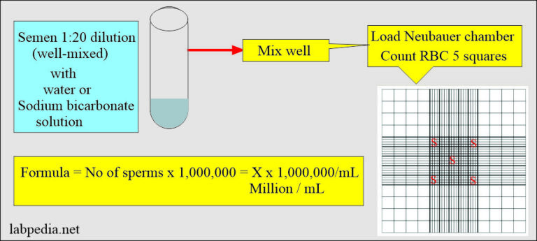 Semen:- Part 1 - Semen analysis, and Semen Counting Procedure ...