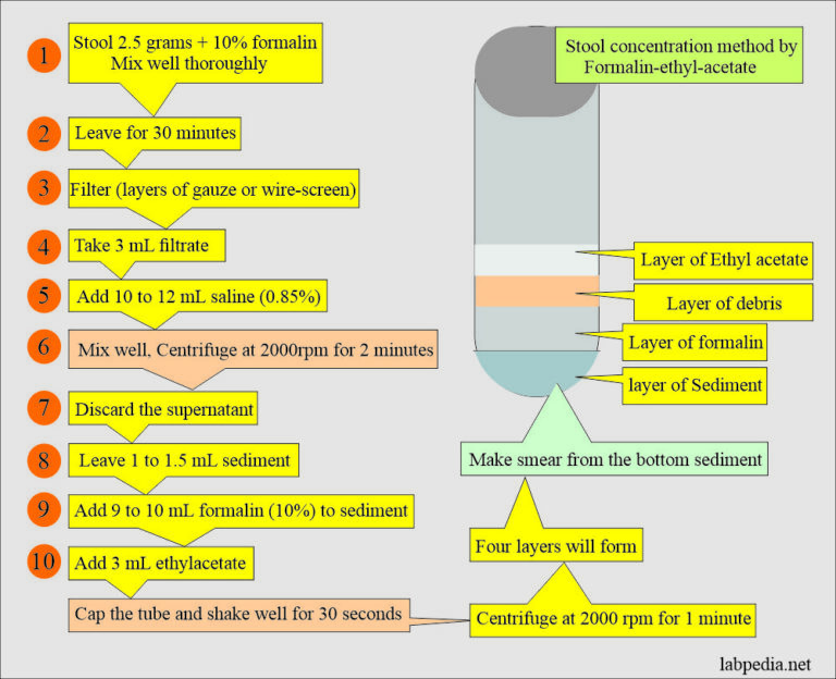 Stool Examination:- Part 2 - Stool Concentration Methods, Stains ...