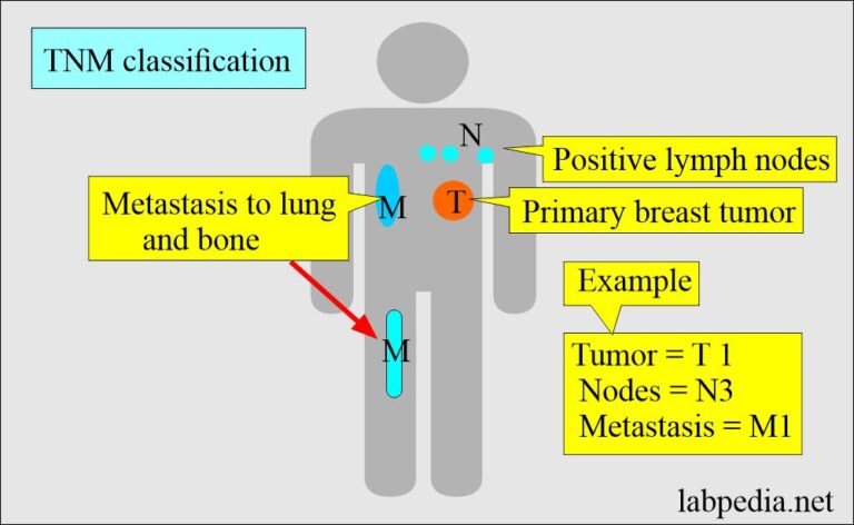 Tumor Markers:- Part 1 - Tumor Markers, Staging and Grading - Labpedia.net