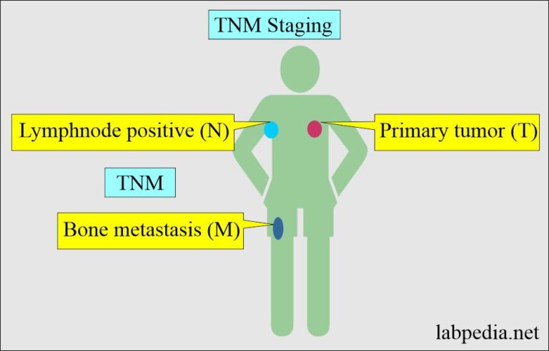 Tumor Markers:- Part 1 - Tumor Markers, Staging and Grading - Labpedia.net