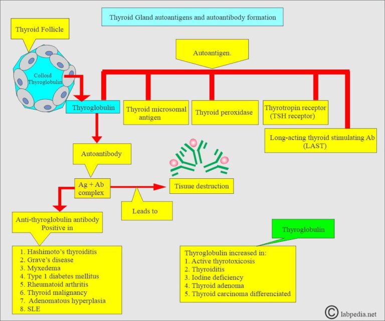 Anti-thyroglobulin antibody (Thyroid autoantibody) - Labpedia.net