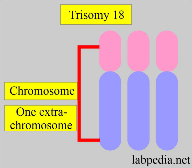 Maternal screening:- Part 2 - Prenatal Screening For Genetic ...