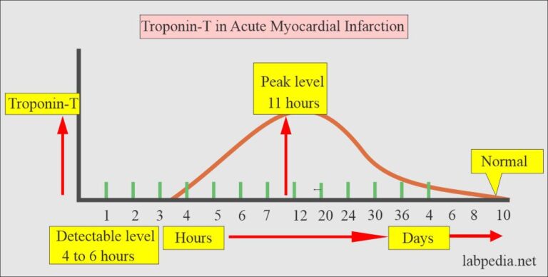 Cardiac marker:- Part 1 - Diagnosis of Acute Myocardial Infarction (AMI ...
