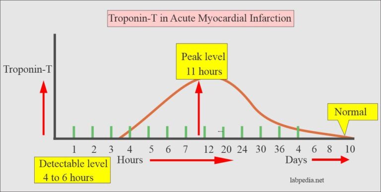 Cardiac marker:- Part 1 - Diagnosis of Acute Myocardial Infarction, AMI ...