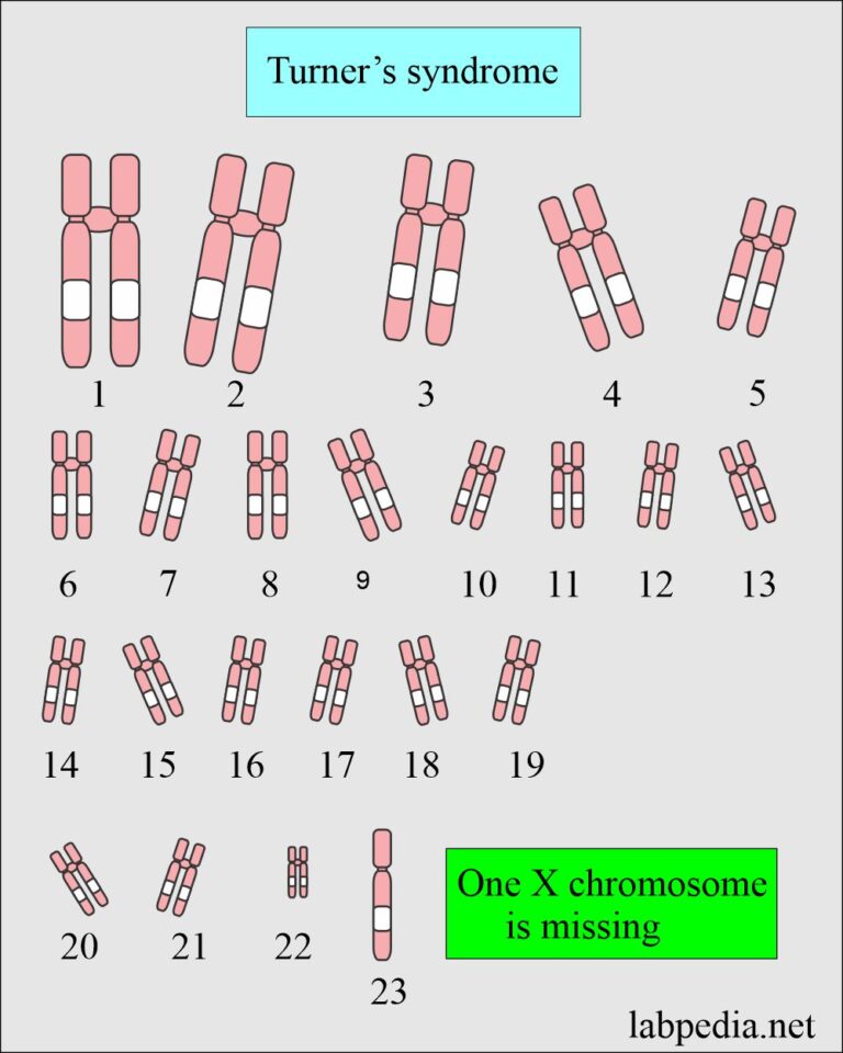 Maternal screening:- Part 2 - Prenatal Screening For Genetic ...