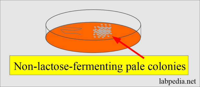Typhoid Fever, Enteric Fever (Salmonella typhi)