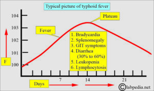 Enteric fever, widal test interpretations