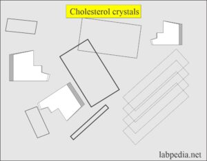 Urine Crystals (Crystalluria) - Labpedia.net