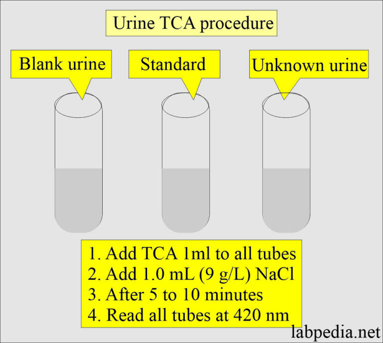 Urine Analysis:- Part 1 - Complete Urine Analysis Discussion - Labpedia.net