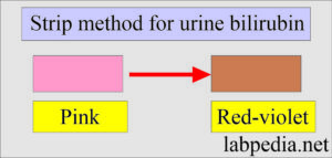 Urine Bilirubin, Bilirubinuria - Labpedia.net