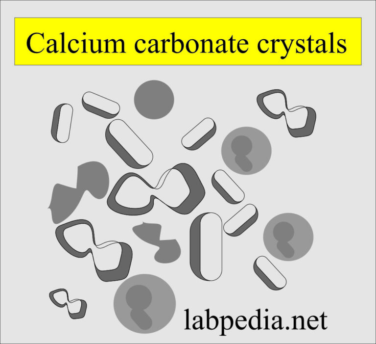 Urine Crystals (Crystalluria) and Their Significance - Labpedia.net