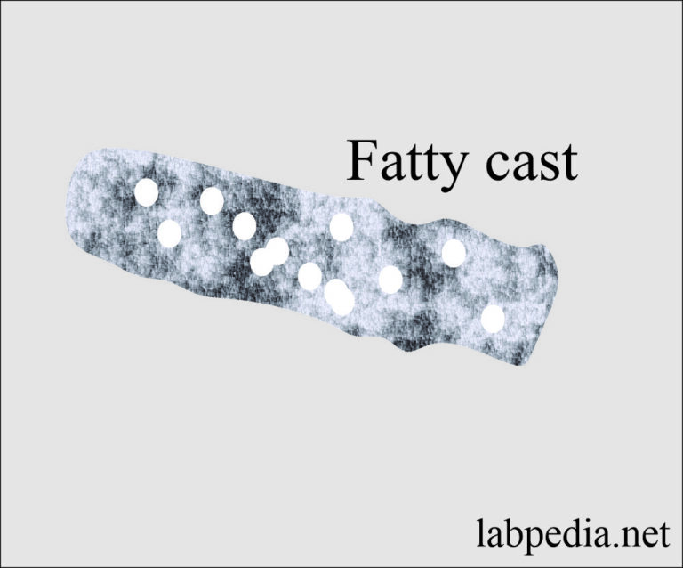 Urine Analysis:- Part 2 -Urine Microscopic Examination and ...