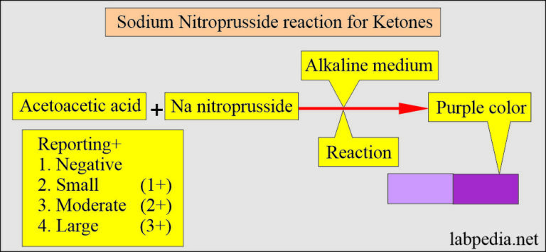 Urine Analysis:- Part 1 - Complete Urine Analysis Discussion - Labpedia.net
