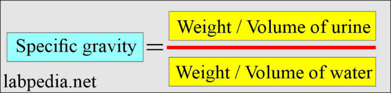 Urine Analysis:- Part 3 - Urine Physical Examination and ...