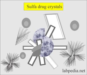 Urine Crystals (Crystalluria) - Labpedia.net