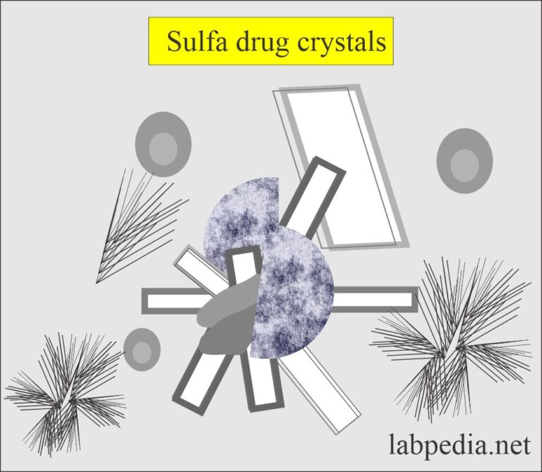 Urine Crystals (Crystalluria) and Their Significance - Labpedia.net