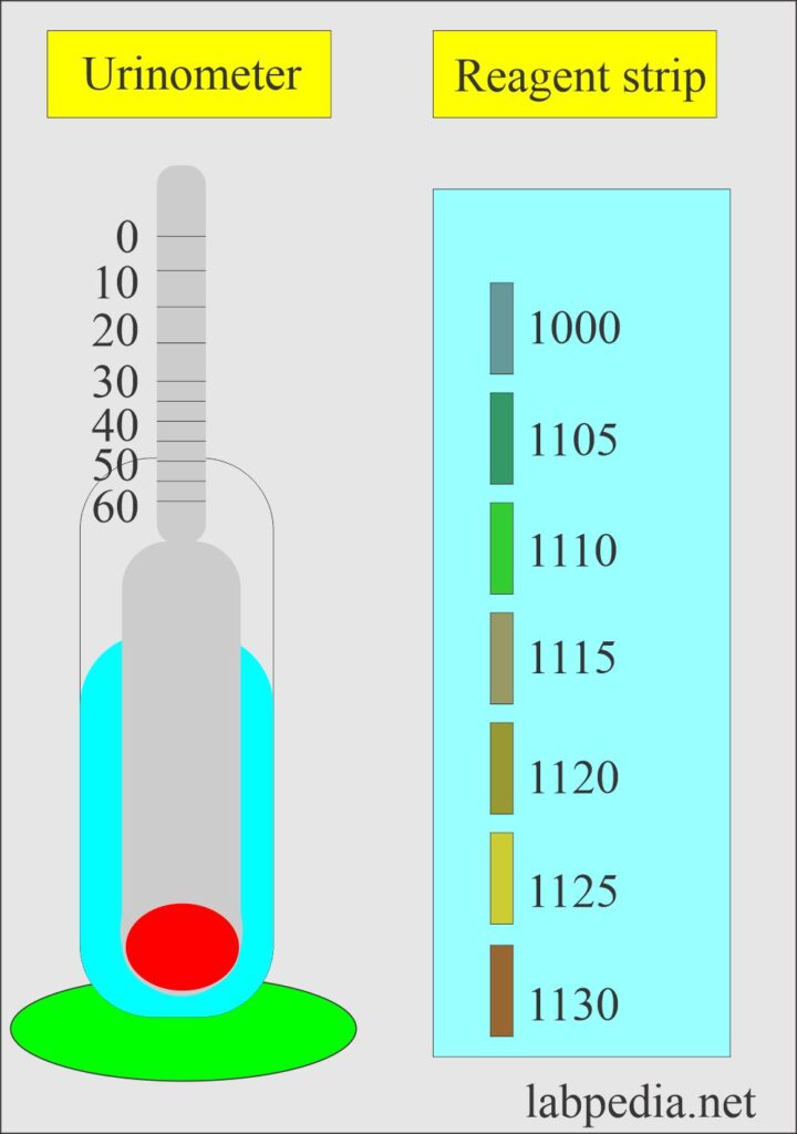 Urine Specific Gravity and Its Significance - Labpedia.net Urine Specific Gravity and Its Significance - Labpedia.net