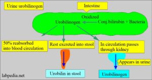 Urine for Urobilinogen