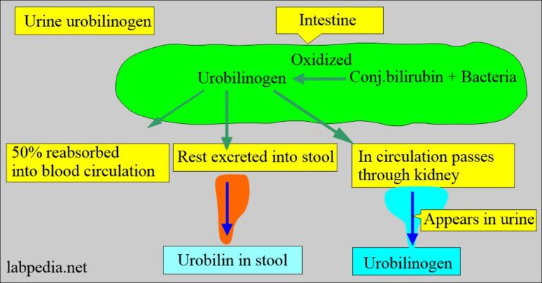 Urine for Urobilinogen