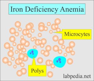 Mean Corpuscular Volume (MCV), Mean Cell Volume - Labpedia.net
