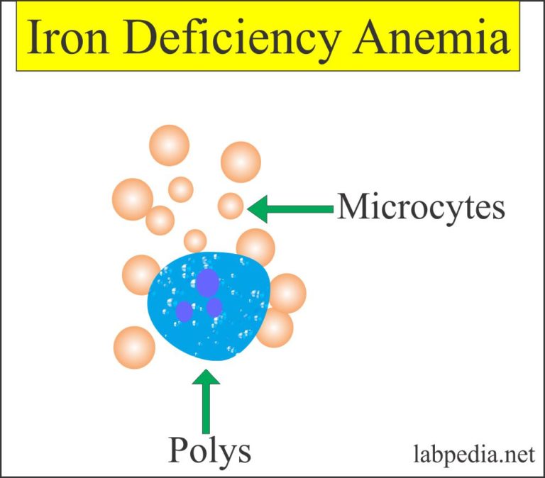 Mean Corpuscular Volume (MCV), Mean Cell Volume - Labpedia.net