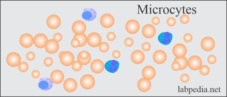 Anemia classification, diagnosis, and routine workup