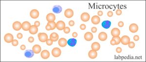 Anemia classification, diagnosis, and routine workup