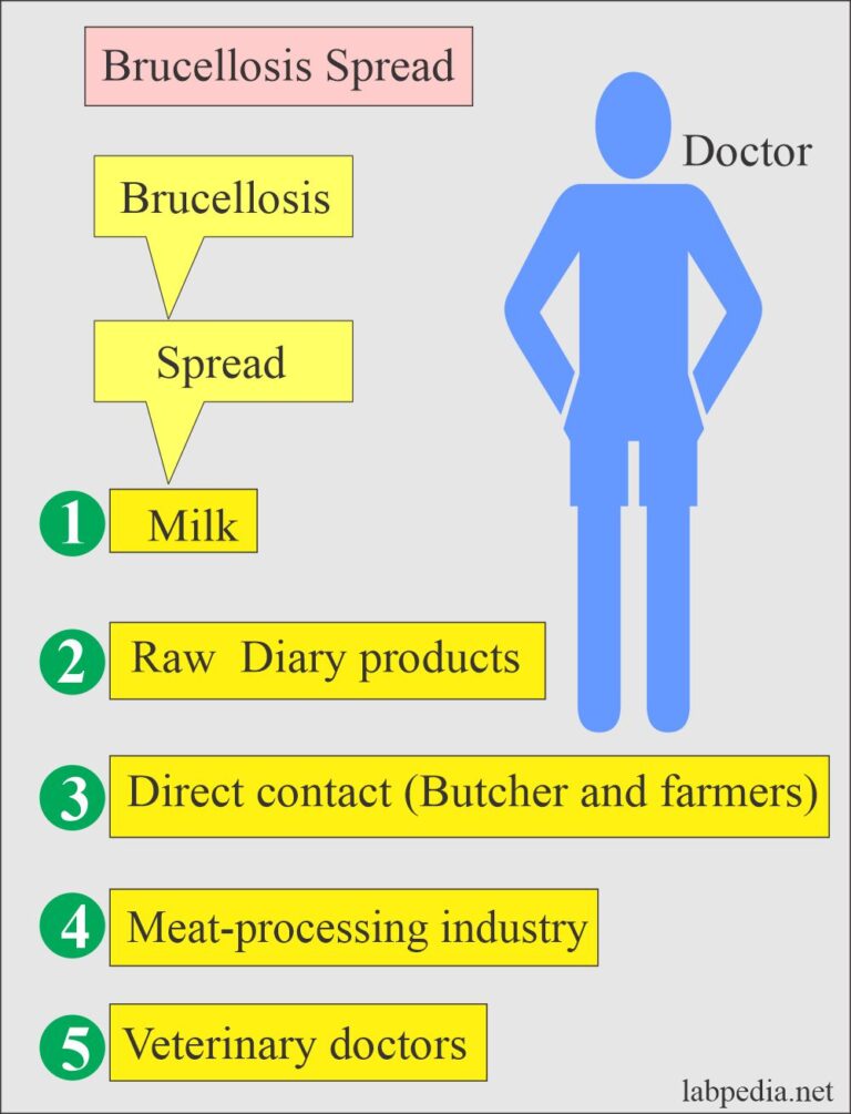 Brucellosis, Diagnosis of Brucella Infection - Labpedia.net