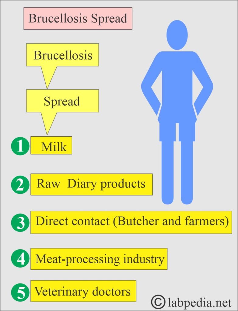 Brucellosis, Diagnosis of Brucella Infection - Labpedia.net