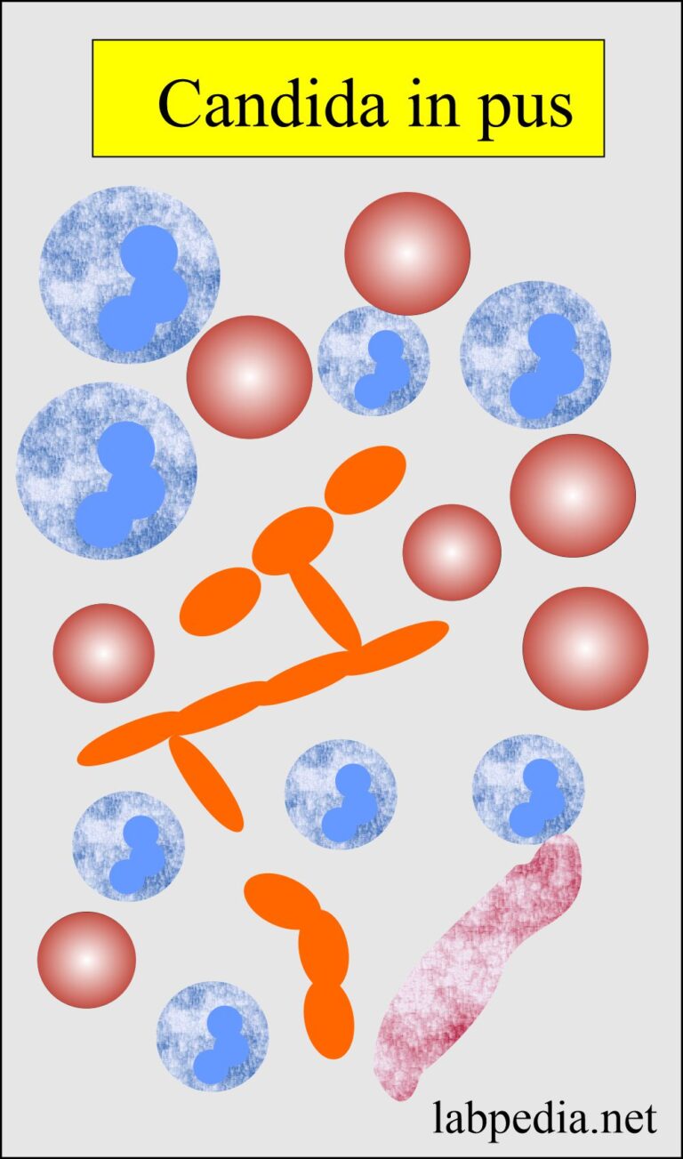 Candidiasis, Candida albicans and Diagnosis - Labpedia.net