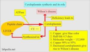 Ceruloplasmin, Copper Toxicity and Wilson's Disease - Labpedia.net