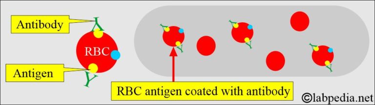 Coomb's test direct for the detection of antibody